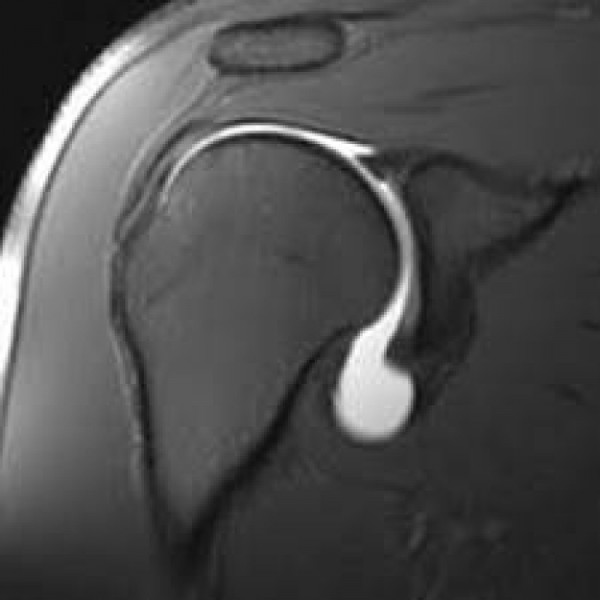 DOK_legamenti_spalla | Corsi Fisioterapisti