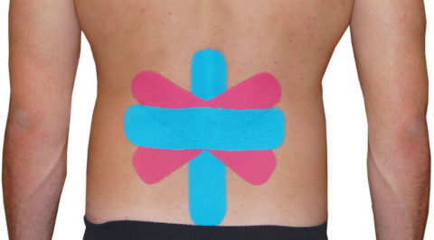 KINESIO TAPING SCHIENA: LA RIVOLUZIONE DIETRO UN ADESIVO | ManiEsperte.it