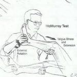 TEST DI MCMURRAY: come si esegue | ManiEsperte.it